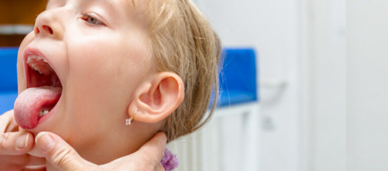 Posted June 19, 2019 at 17:13 by seo & filed under Uncategorized